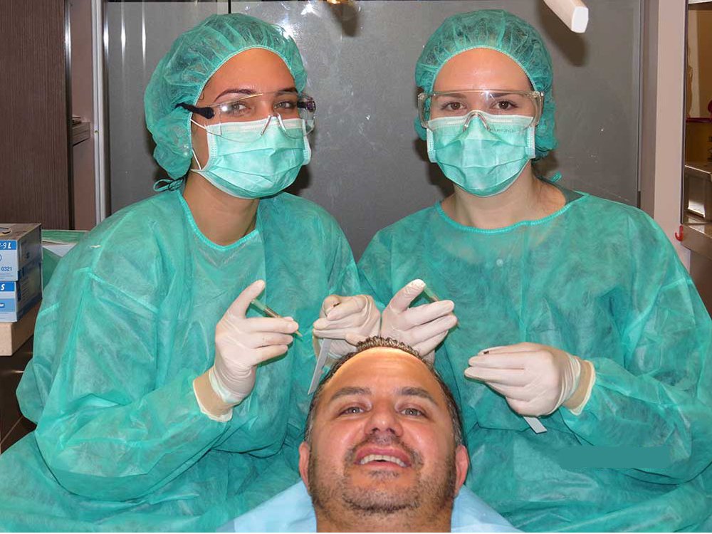 Implante capilar de biofibre - Exoderm Peel